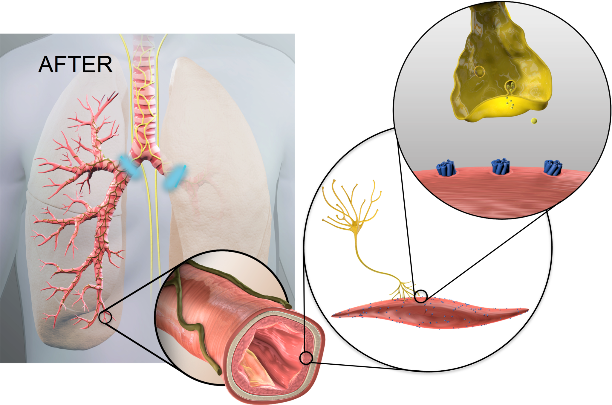 Technology - Nuvaira